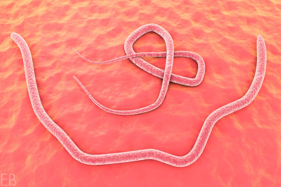 How I Got Rid of Internal Worms (Natural Parasite Remedy) - Eat Beautiful